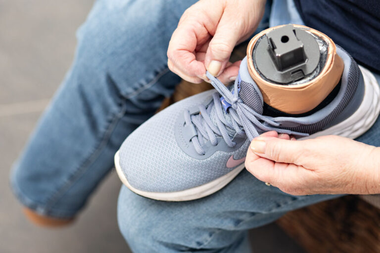 Prosthetic Quick Change Adapter - Lindhe Xtend